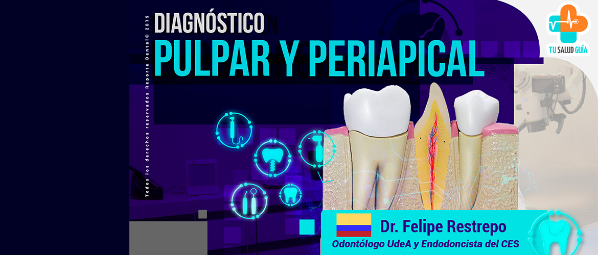 Diagnóstico pulpar y periapical | Directorio Médico | Tu Salud Guía